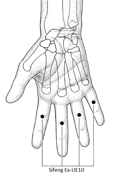 L’AGOPUNTURA DEL SIFENG (EX-UE10) PER L’ANORESSIA. - Airas